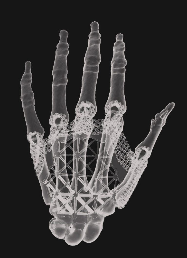 An artist is prototyping a hand grown out of human stem cells - Ars ...