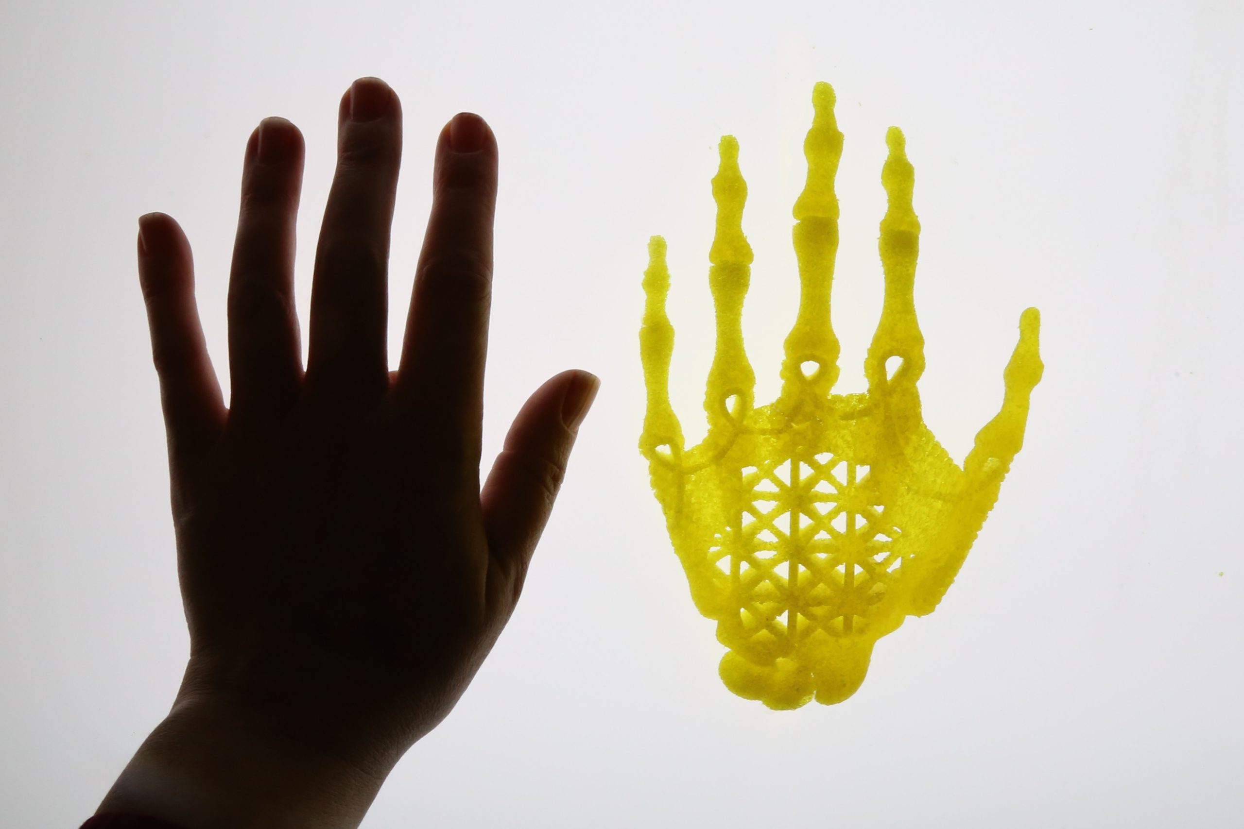 An artist is prototyping a hand grown out of human stem cells - Ars ...