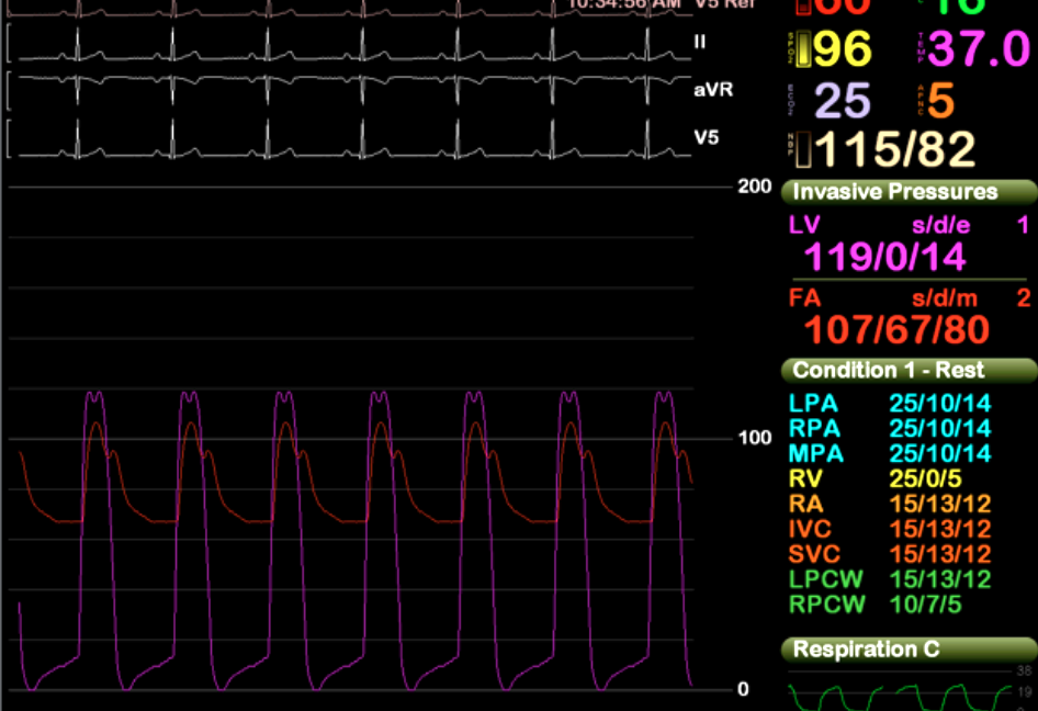 That time a patient’s heart procedure was interrupted by a virus scan ...