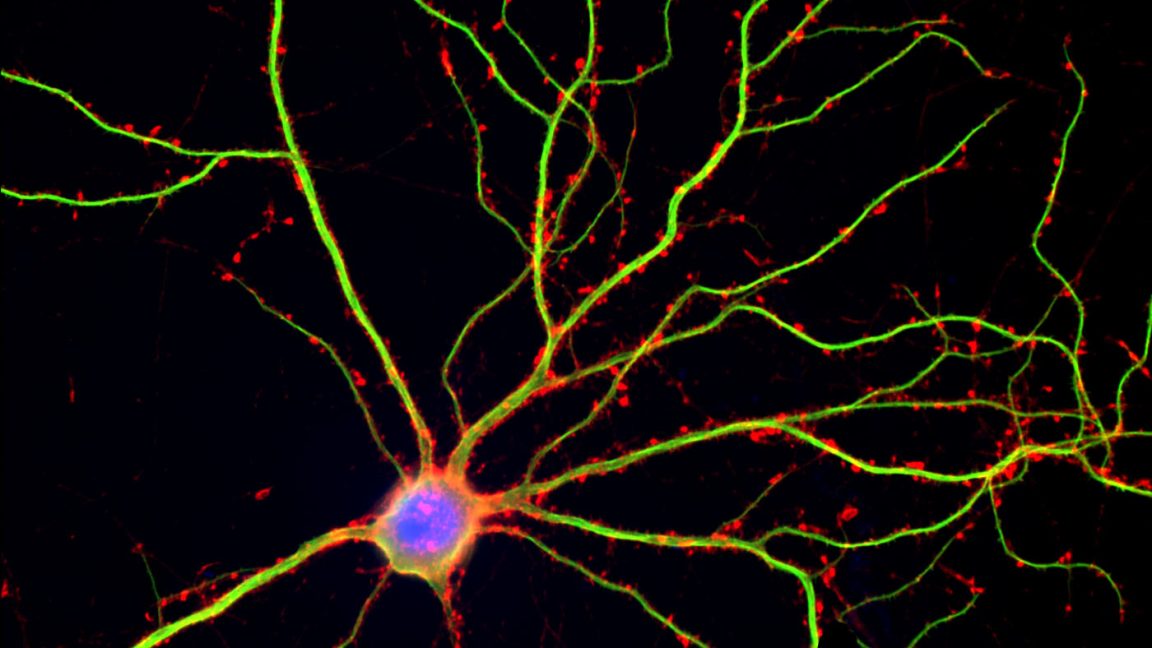Neurons that interpret vision can swap eyes, switch back - Ars Technica