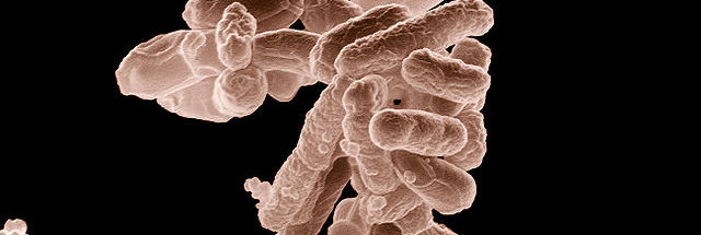 The antibiotic “apocalypse” has been happening for years—we just didn’t ...