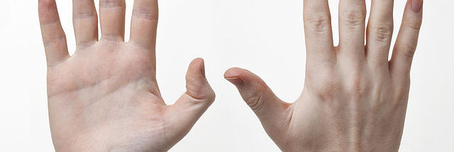 The man who got the first double hand transplant wishes he hadn’t | Ars ...