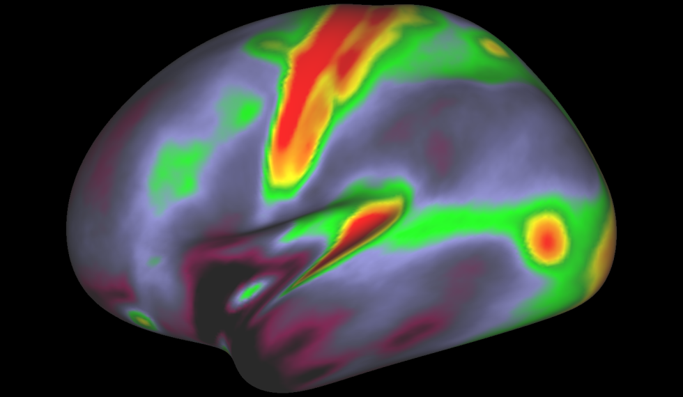 New brain map more than doubles charted regions of the human noggin ...