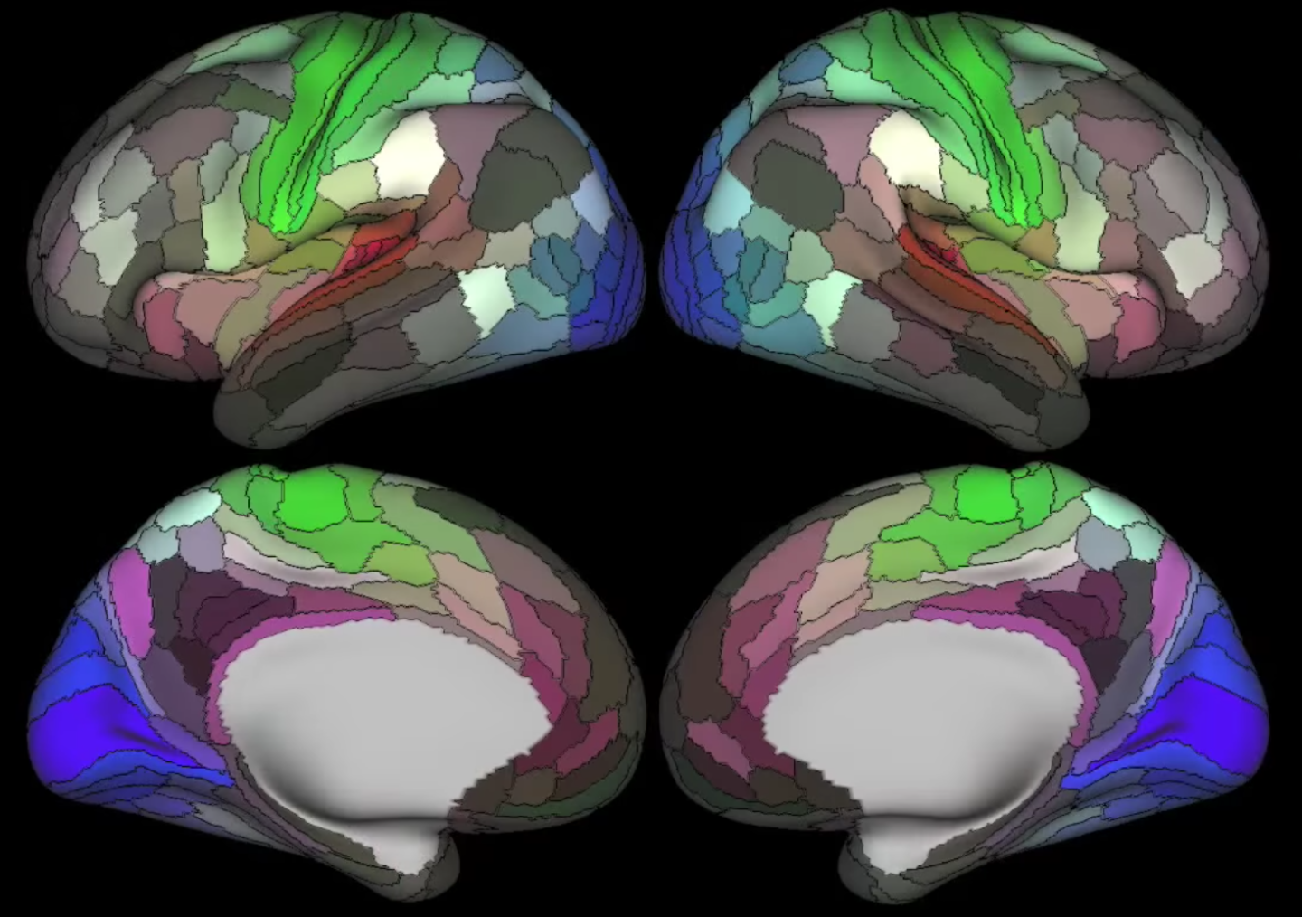 New brain map more than doubles charted regions of the human noggin ...