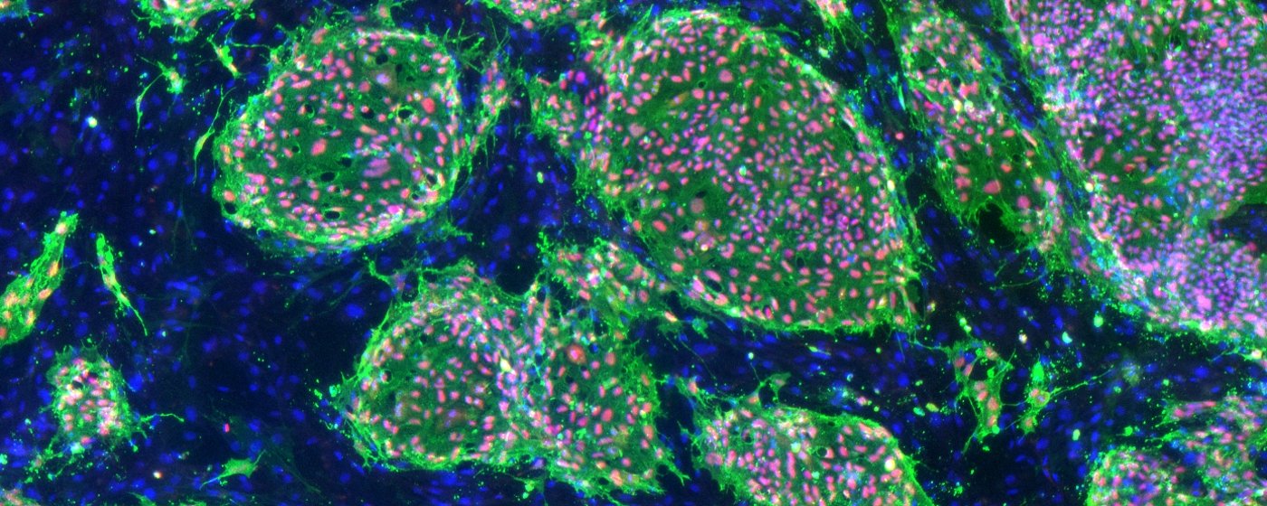 US alters rules for funding for animals with human stem cells - Ars ...