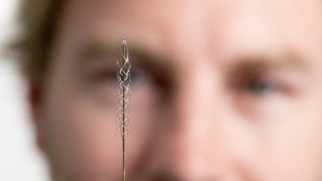 Building a bionic spine - Ars Technica