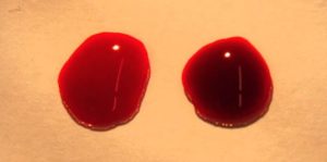 Tiny beads can deliver oxygen straight to the blood stream - Ars Technica