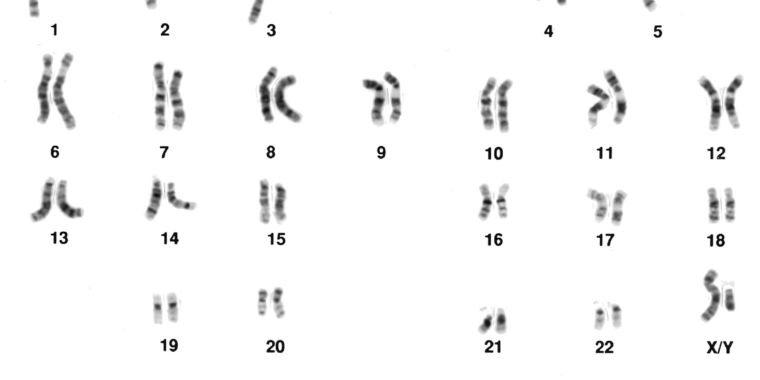 Some genetic disorders may be caused by defects we couldn’t detect ...