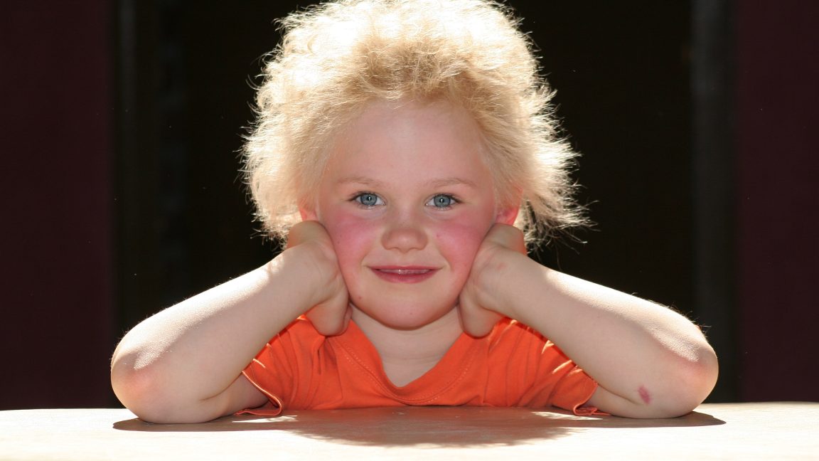 Uncombable Hair Syndrome is real, and now we know what causes it - Ars ...