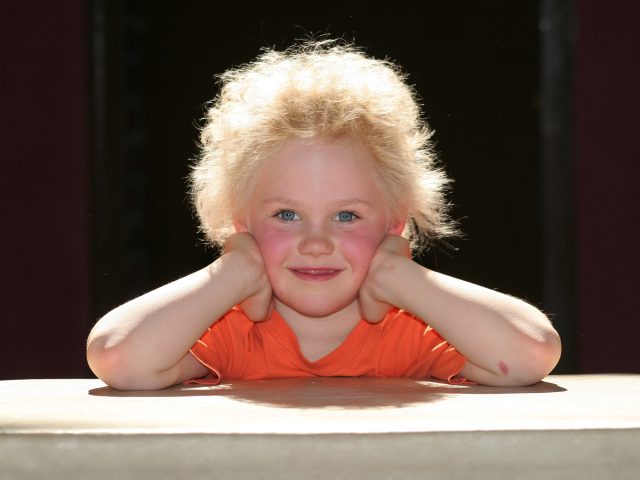 Uncombable Hair Syndrome is real, and now we know what causes it - Ars ...