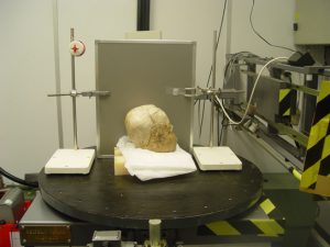 This man’s skull was ritualistically transformed 9,000 years ago in ...