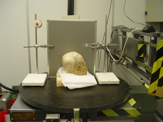 This man’s skull was ritualistically transformed 9,000 years ago in ...