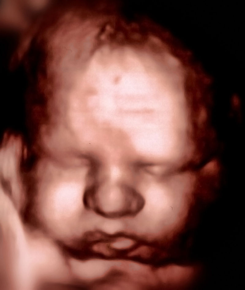 Shouldn t Evolution Keep Humans From Having Dangerous Childbirths Shouldn t Evolution Keep Humans From Having Dangerous Childbirths