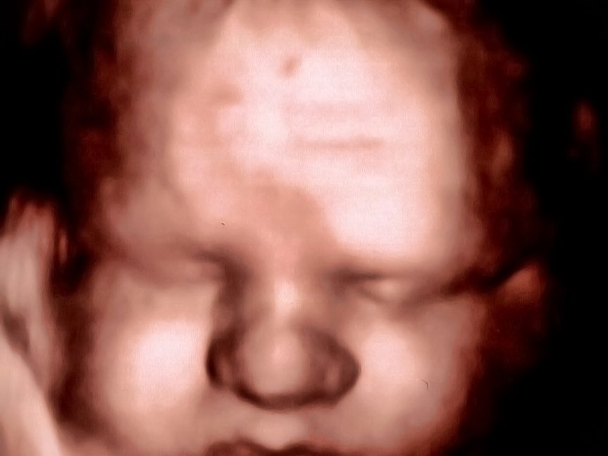 Shouldn’t evolution keep humans from having dangerous childbirths ...