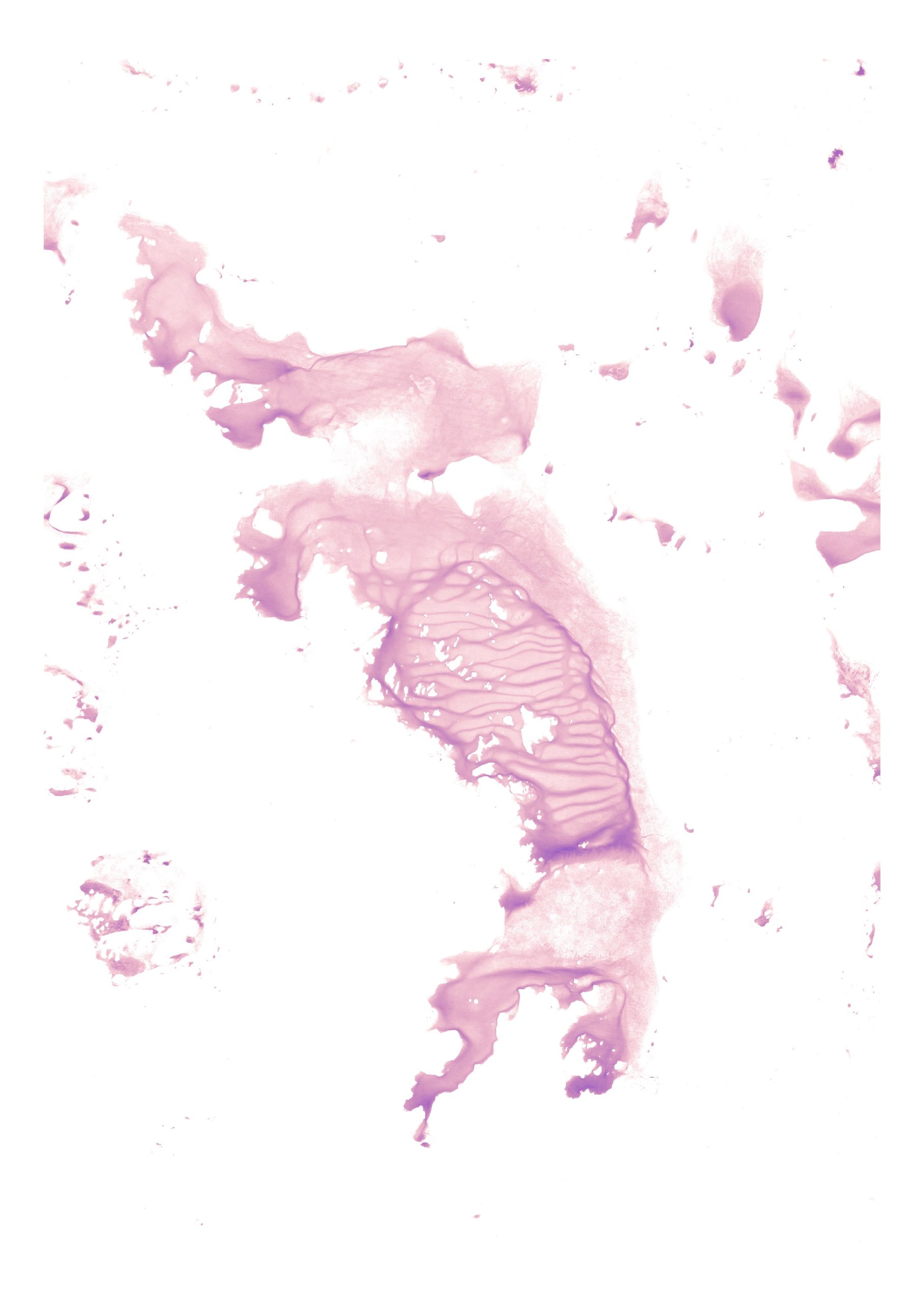 Surface water is disappearing—and reappearing—globally - Ars Technica