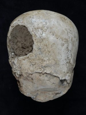 This man’s skull was ritualistically transformed 9,000 years ago in ...