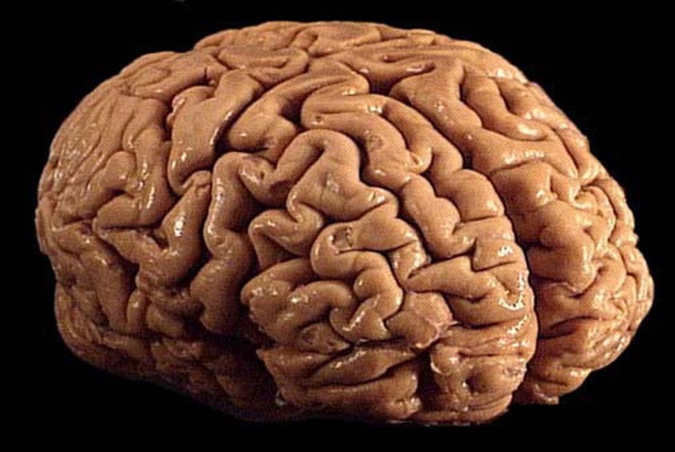 “Brains in a dish” move out of science fiction and into the lab - Ars ...