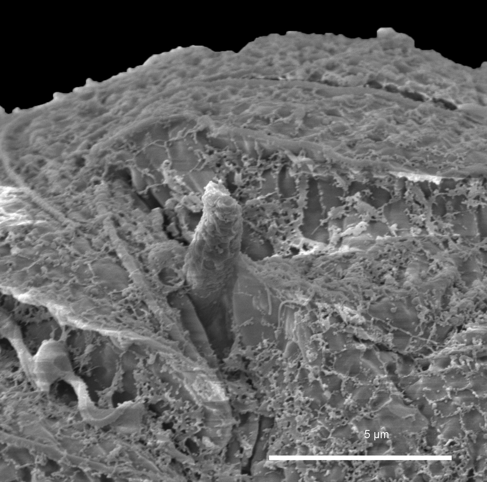 First high-res look at microbial ballistics: Harpoons, spears, Gatling ...