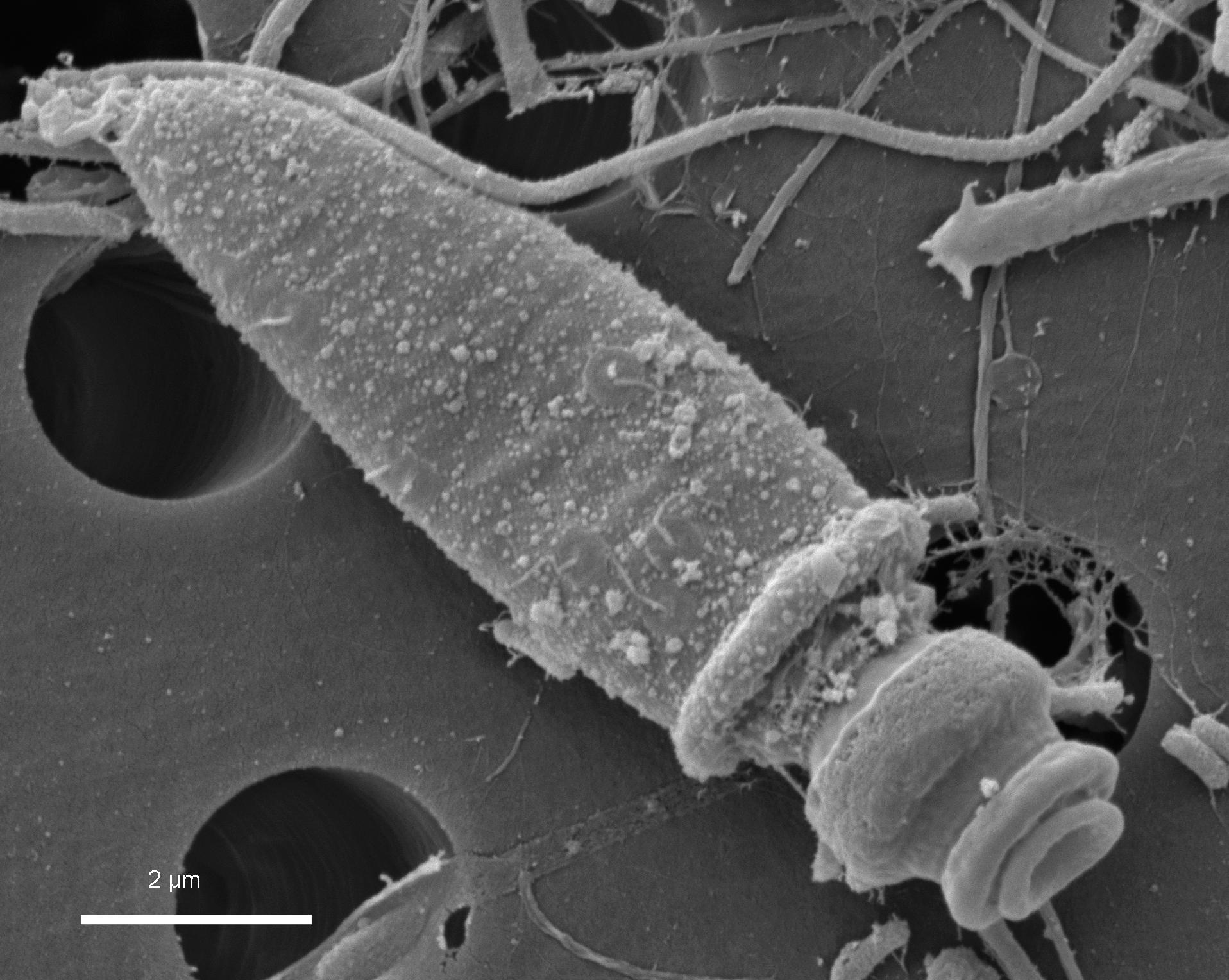 First high-res look at microbial ballistics: Harpoons, spears, Gatling ...