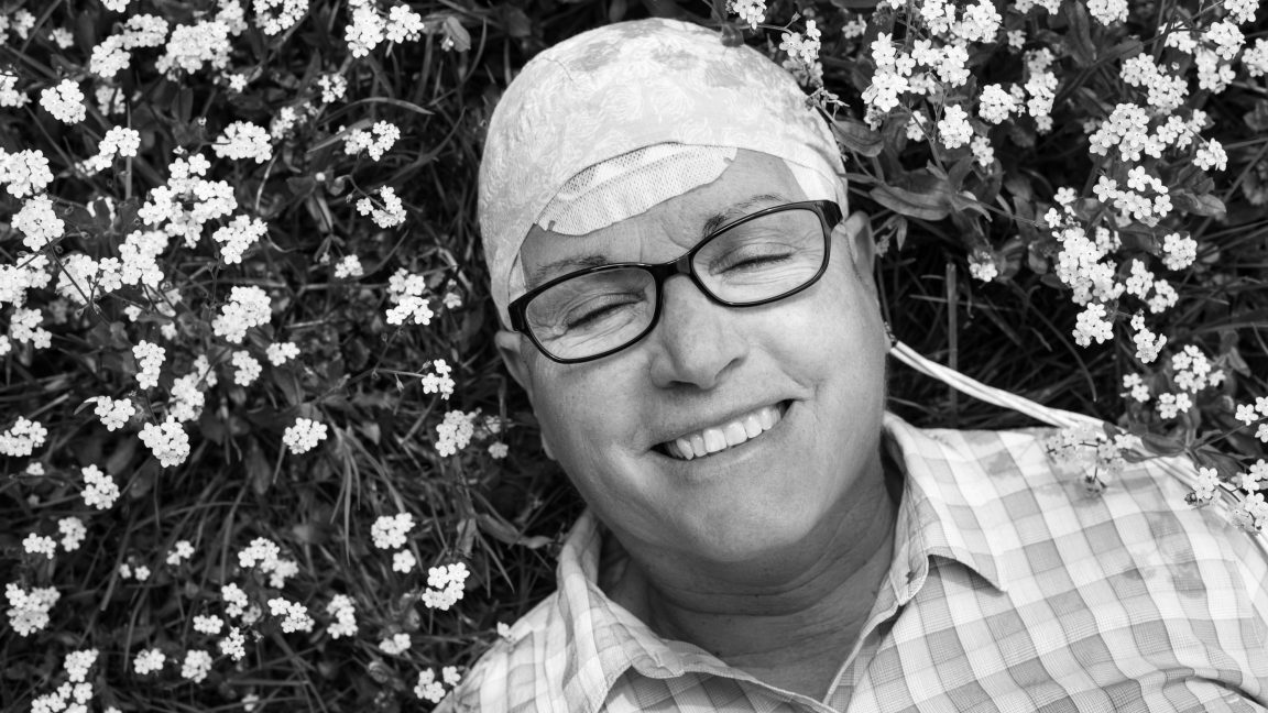 Brain cancer patients live longer wearing electric cap designed to zap ...