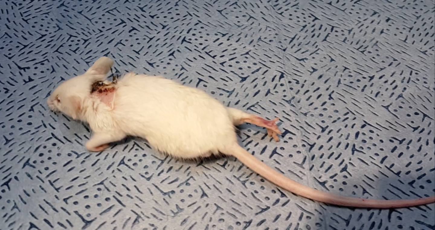 “Out of his mind” surgeon plans human head transplant, revival of ...