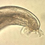Worm that jumps from rats to slugs to human brains has invaded ...