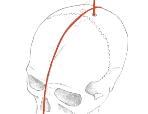 Remains from “skull cult” discovered at world’s oldest stone monuments ...