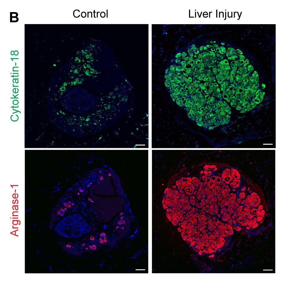 Human liver cells seeded in mouse expands 50-fold to functional ...