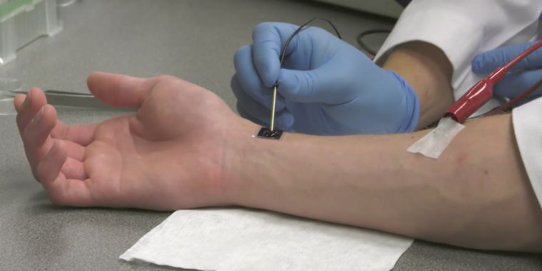 Heal thyself: Skin-zapping chip aims to reprogram cells for tissue ...