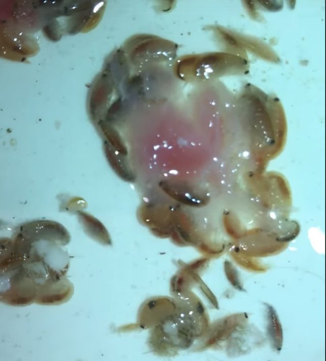 Australian teen chewed and bloodied after bizarre ocean feeding frenzy ...