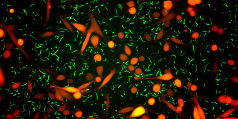 See jerkface bacteria hiding in tumors and gobbling chemotherapy drugs ...