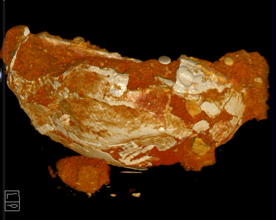 “Completely unique” Iron Age party cauldrons and more unearthed in ...