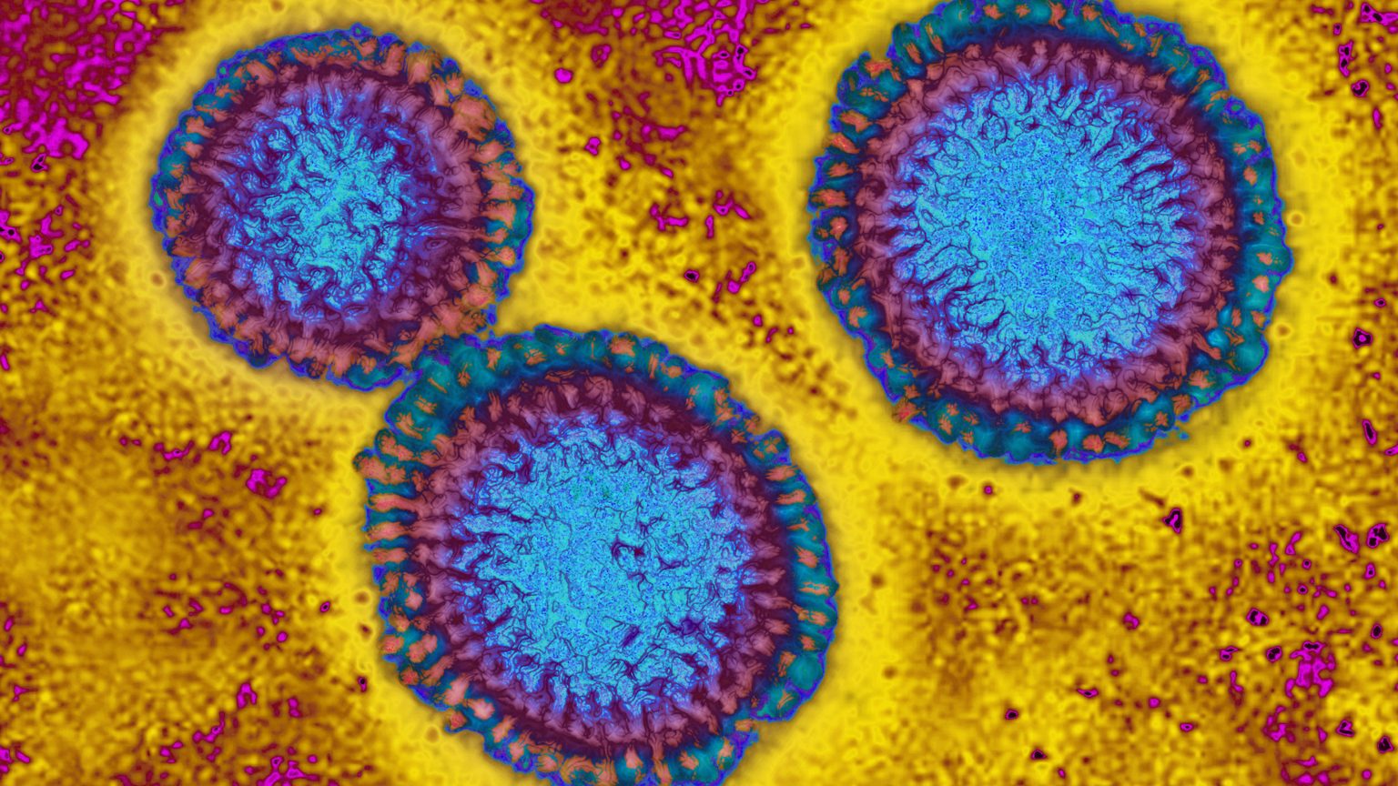 This flu season looks grim as H3N2 emerges with mutations - Ars Technica