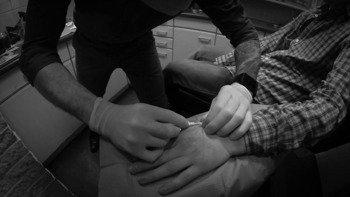 A practical guide to microchip implants - Ars Technica