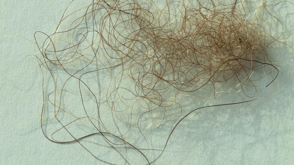 Shocker: “Yeti” poo, bones not actually from yeti - Ars Technica