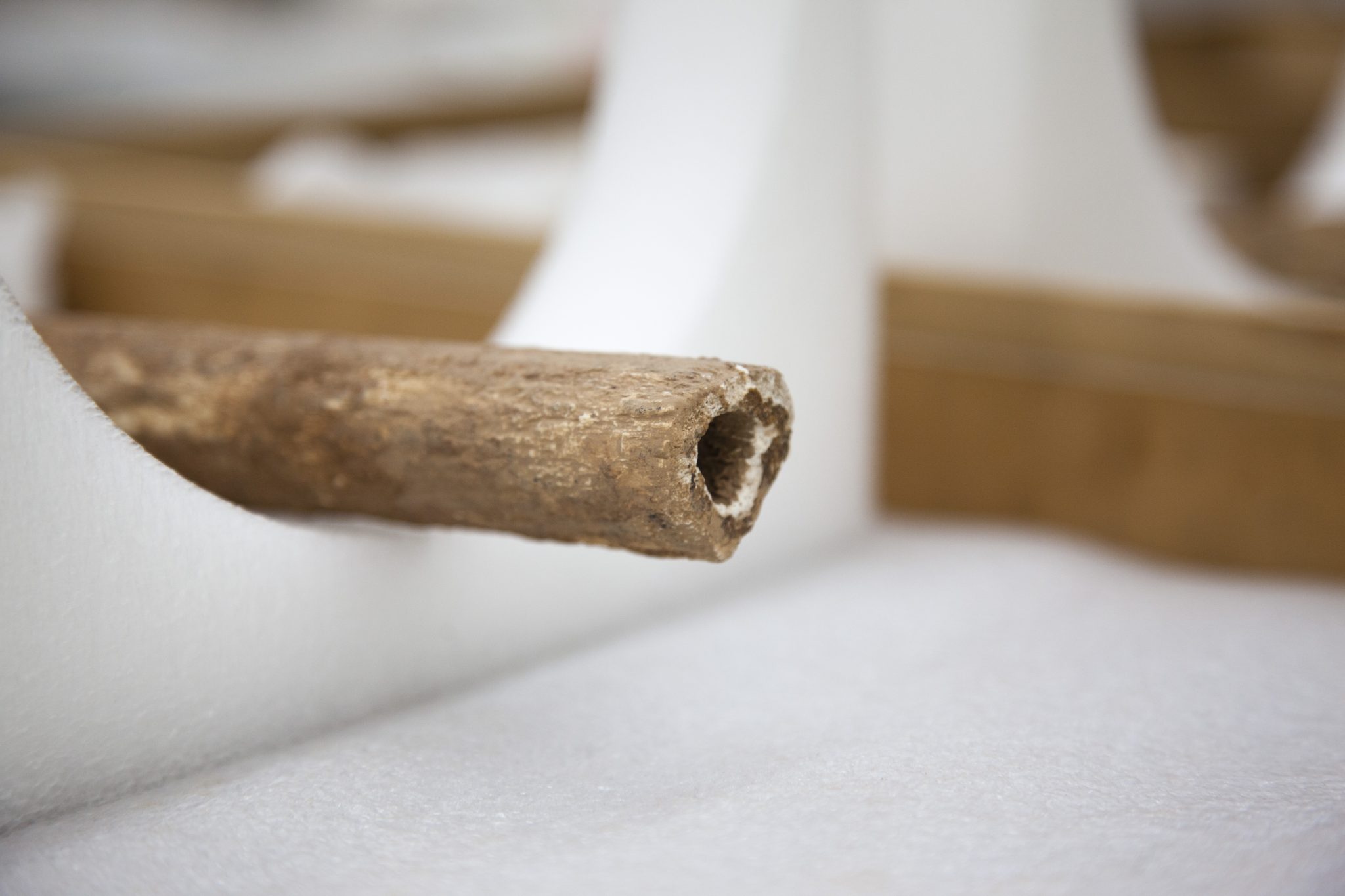 Grim look at Civil War surgery unearthed by new pit of limbs, bodies ...