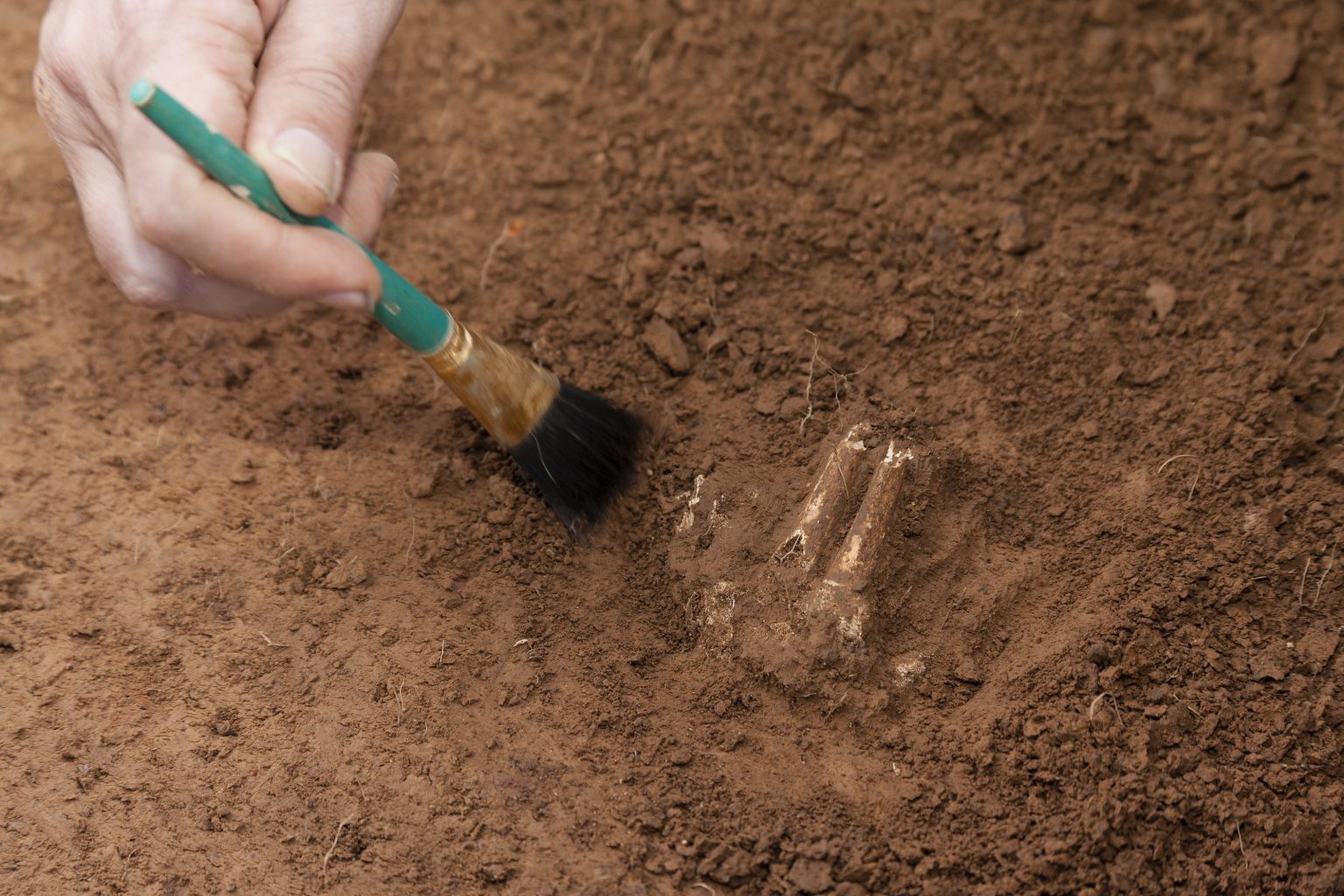 Grim look at Civil War surgery unearthed by new pit of limbs, bodies ...