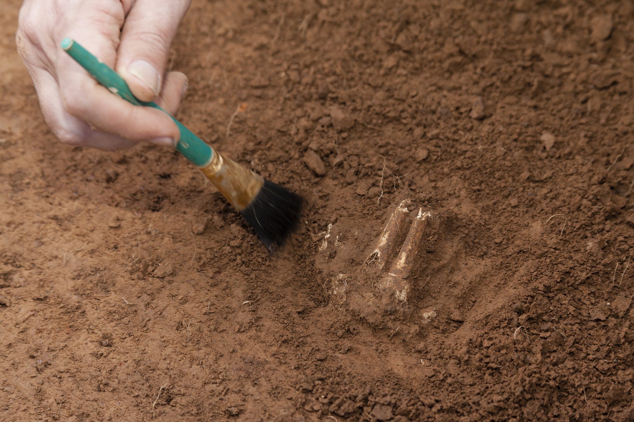Grim look at Civil War surgery unearthed by new pit of limbs, bodies ...
