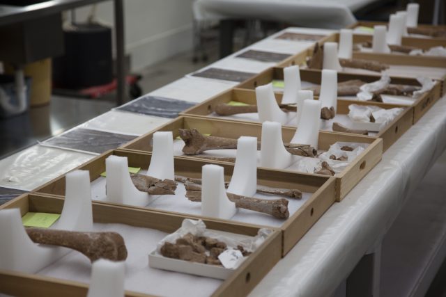 Grim look at Civil War surgery unearthed by new pit of limbs, bodies ...