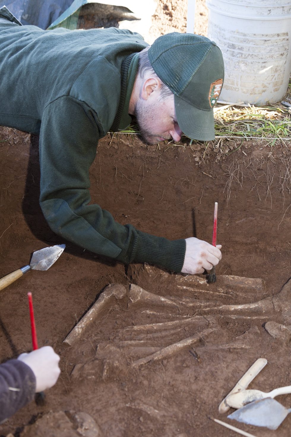 Grim look at Civil War surgery unearthed by new pit of limbs, bodies ...
