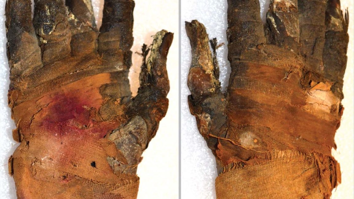 New imaging tech gives us the finger (of a mummy) - Ars Technica