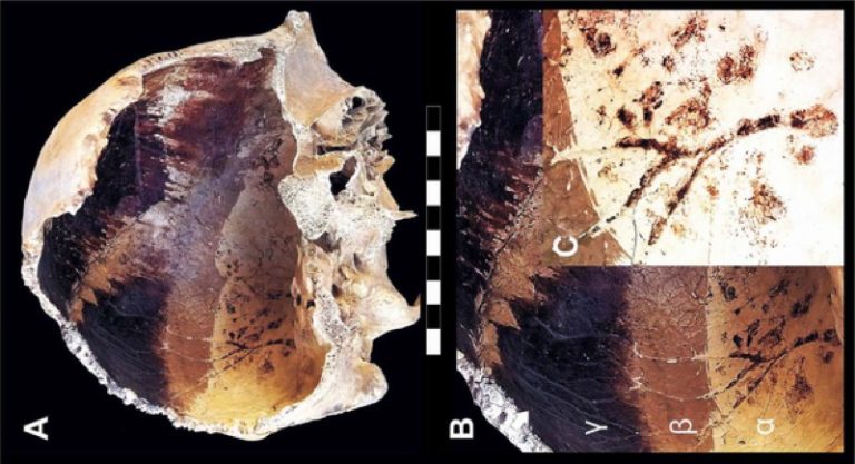 Extreme heat of Vesuvius eruption vaporized body fluids, exploded ...