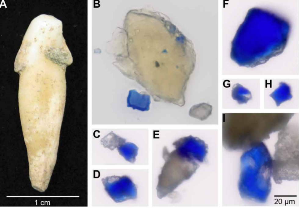 A medieval woman’s work left blue pigment on her teeth - Ars Technica