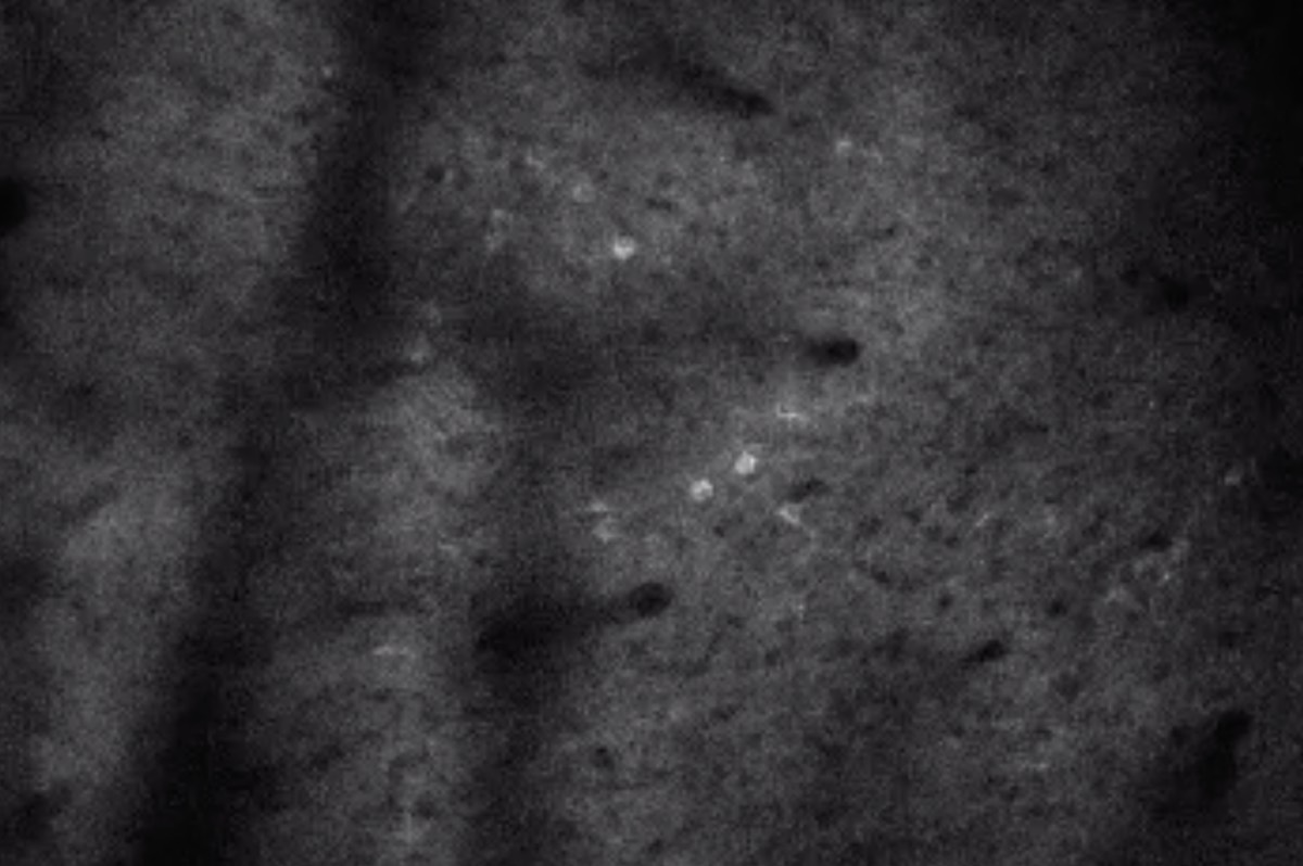 Hallucinating mice bring us one step closer to what’s going on in the ...