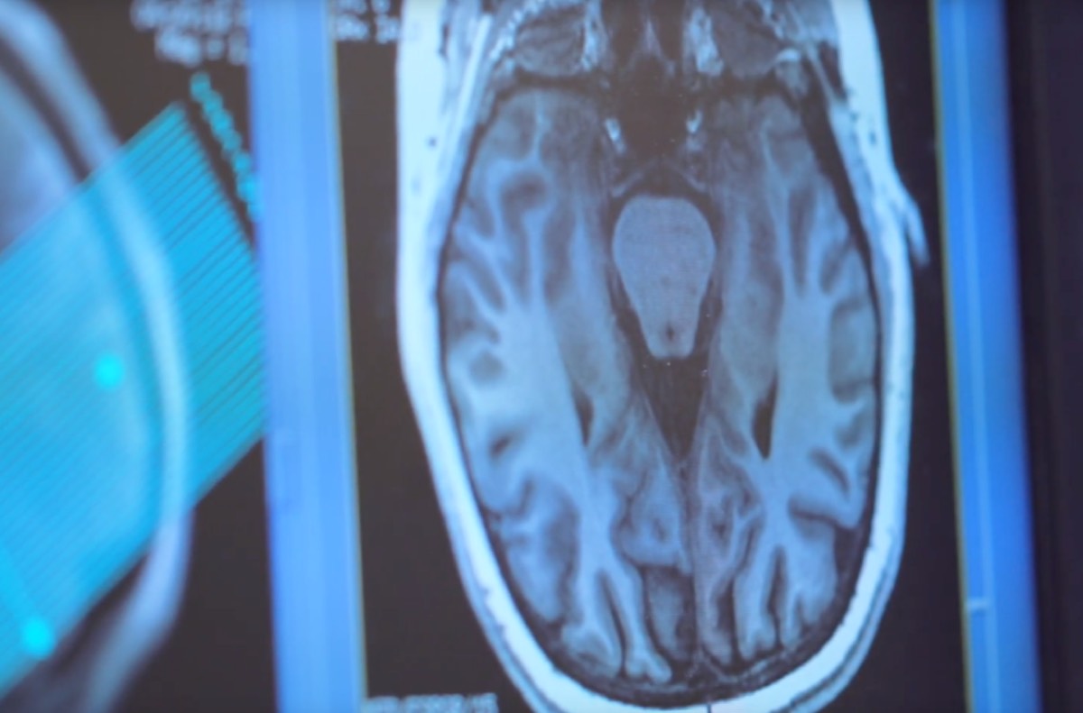 Pokémon characters have their own pea-sized region in brain, study ...