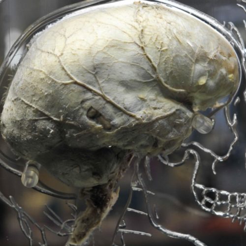 Tag: neurophysics - Ars Technica