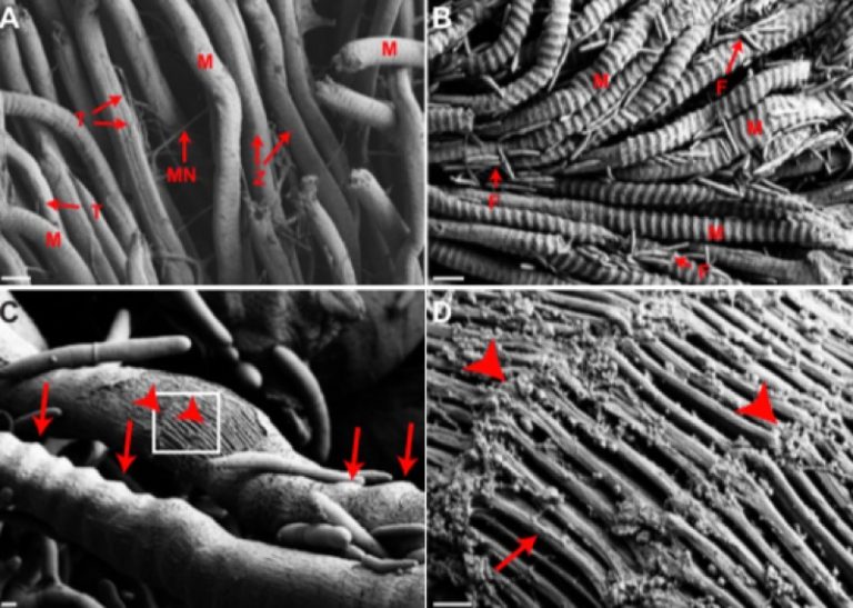 Zombifying fungus bypasses the brain to make ants its puppets, study ...