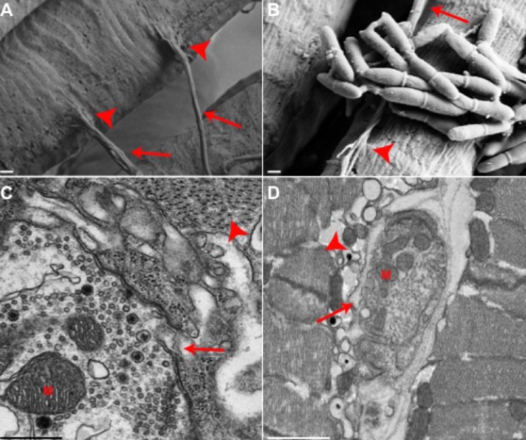 Zombifying fungus bypasses the brain to make ants its puppets, study ...