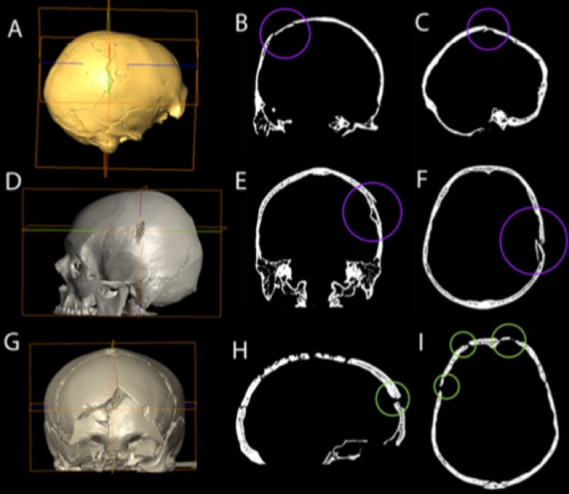 Study concludes 33,000-year-old skull shows signs of blunt-force trauma ...