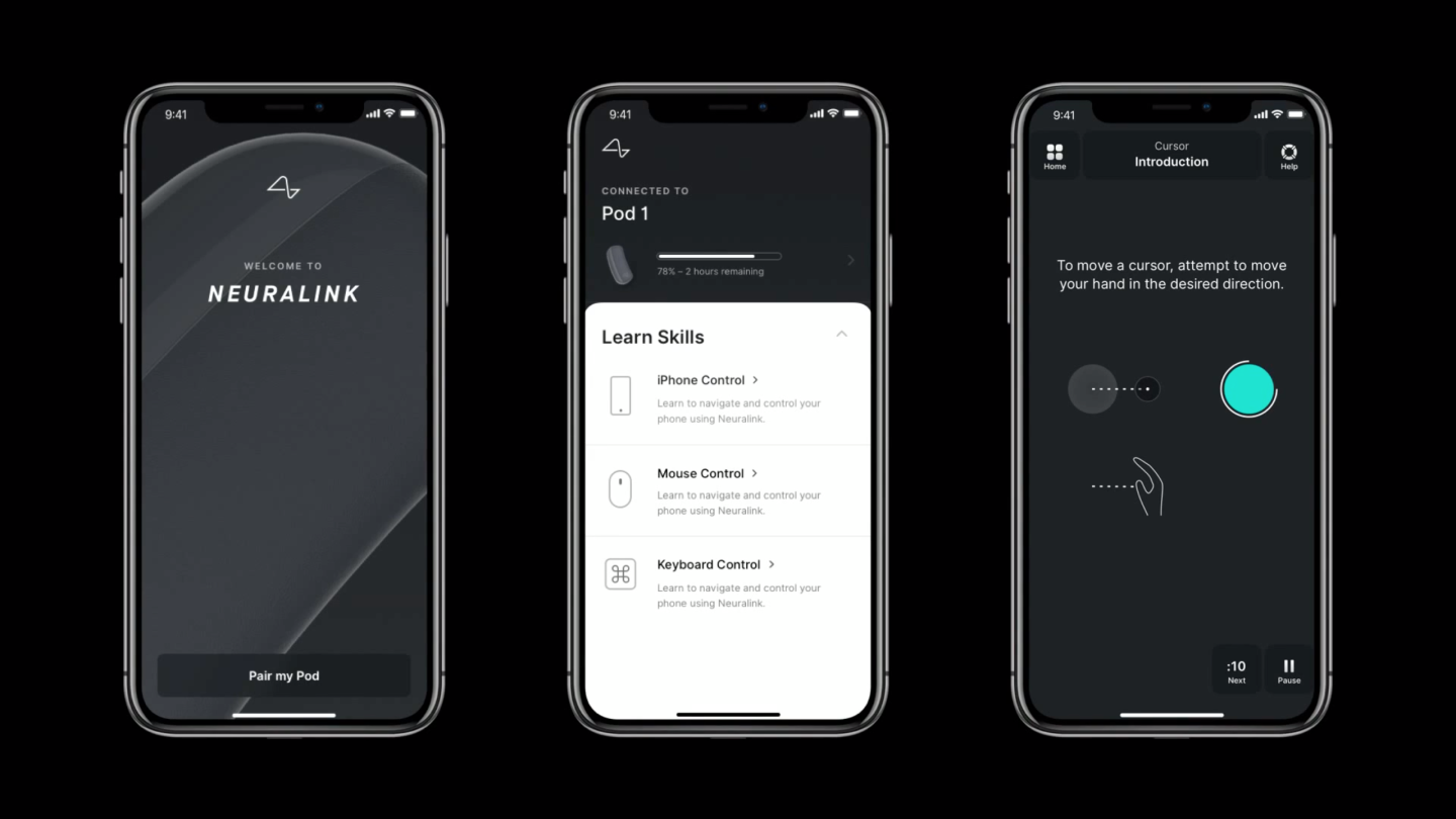 Elon Musk’s Neuralink: Both an evolution and a plan for radical change ...